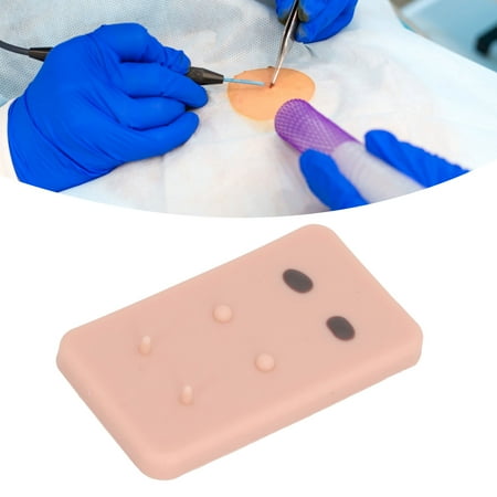 Skin Tag Nevus Seborrheic Keratosis Module, Epidermal Disease Silicone ...