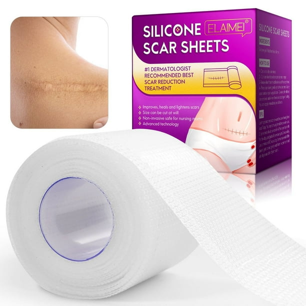 1.5m Silicone Scar Sheets Gel Tape Roll Scars Removal Skin Patch Tapes ...