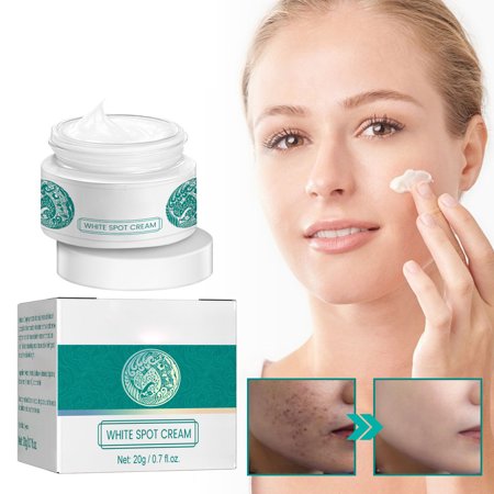 DFC Melasma Melasma Melasma White Freckle Face Quickly Melasma - Walmart.ca