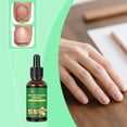 HWRETIE Ginger Nail Care Essence Softens Brightens Nails Hand and Foot ...