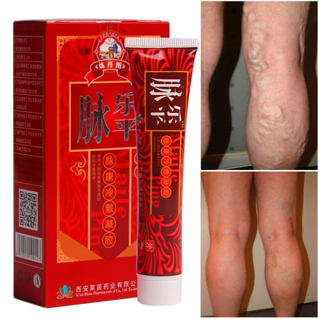 2PC Varicose Vein Cream Phlebitis Angiitis Inflammation Itching Lumps ...