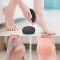 MARYTON Pumice Foot Stone, Natural Lava Callus Remover, Exfoliating ...