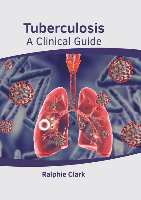 Tuberculosis: A Clinical Guide (Hardcover) - Walmart.com