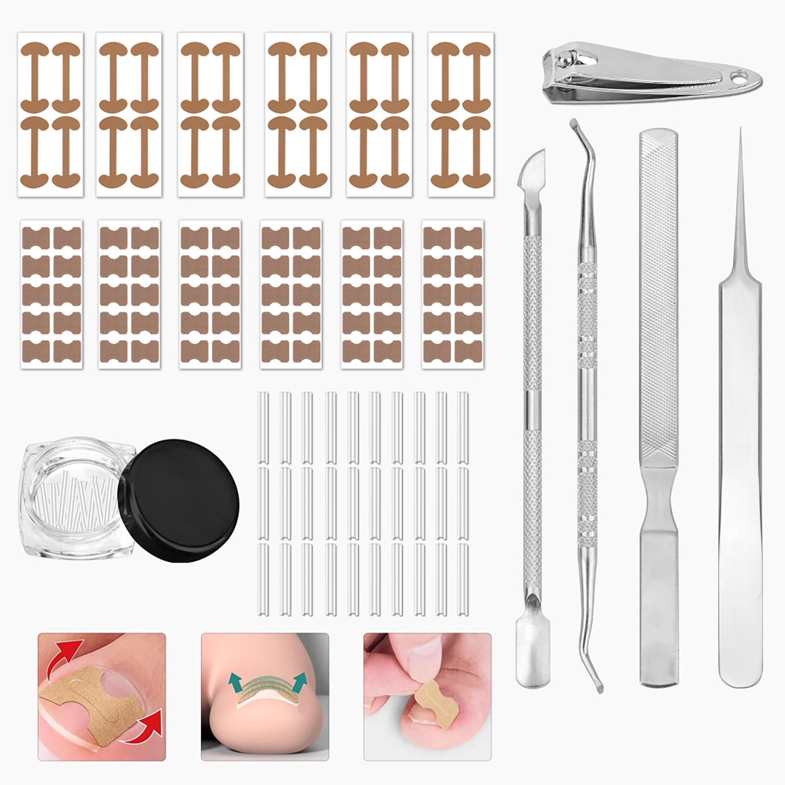 Click here for Egnmcr Ingrown Toenail Set With Breathable Ingrown... prices