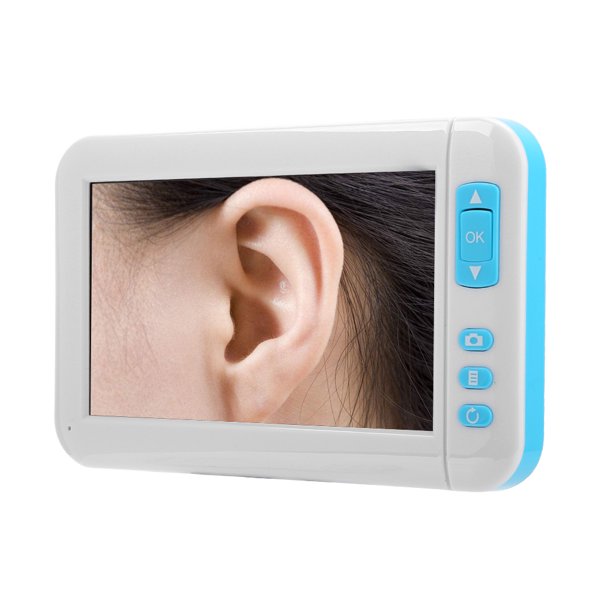 Ear Inspection Camera,4.3in TFT Ear Otoscope Ear Otoscope Inspection ...