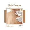 Skin Cancer: Recognition and Management, (Hardcover) - Walmart.com