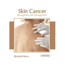 Skin Cancer: Recognition and Management (Hardcover) - Walmart.com