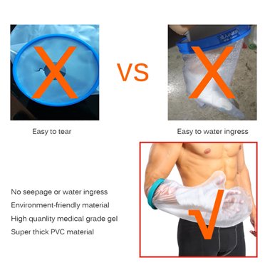 Mgaxyff Hand Cast,Waterproof Cast Bandage Protector Wound Fracture Hand ...