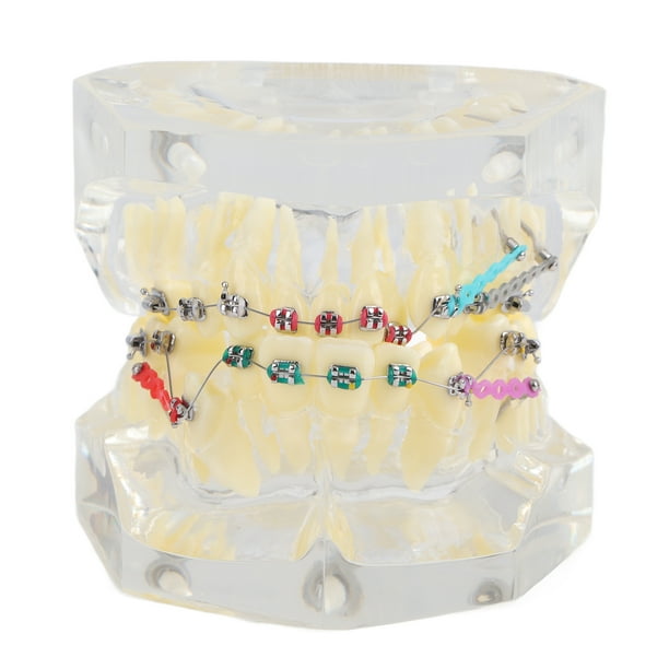 Model, Wire Chain Brackets Model, Treatment Malocclusion For Education ...