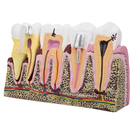 Teeth Models,Dental Teeth Model Oral Physiological Model Dental Model ...