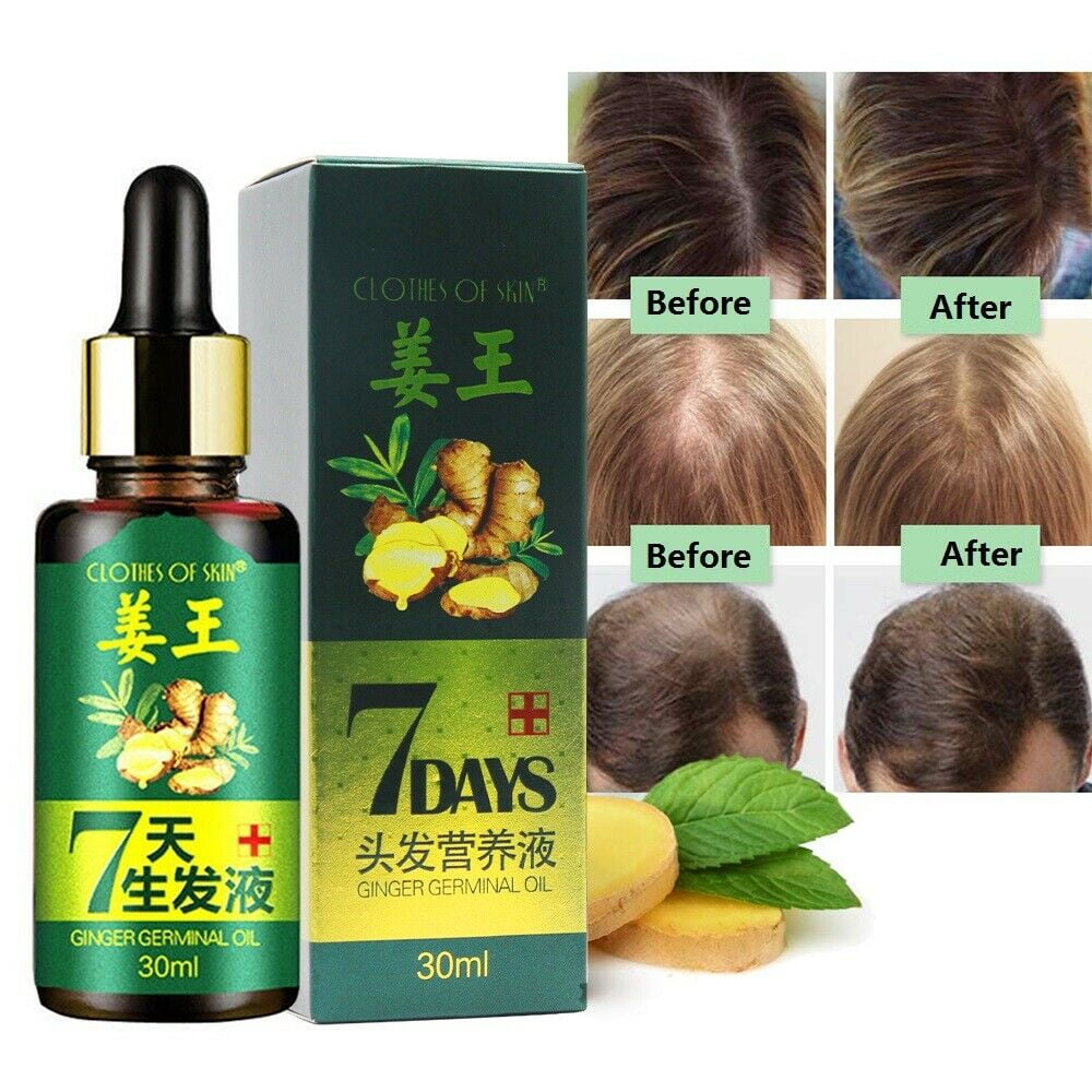 Regrow 7 Day Ginger Germinal Hair Growth Serum Hairdressing Oil Loss