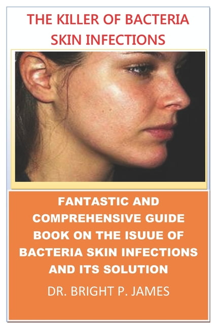 The Killer of Bacteria Skin Infection. : A Comprehensive Book on ...