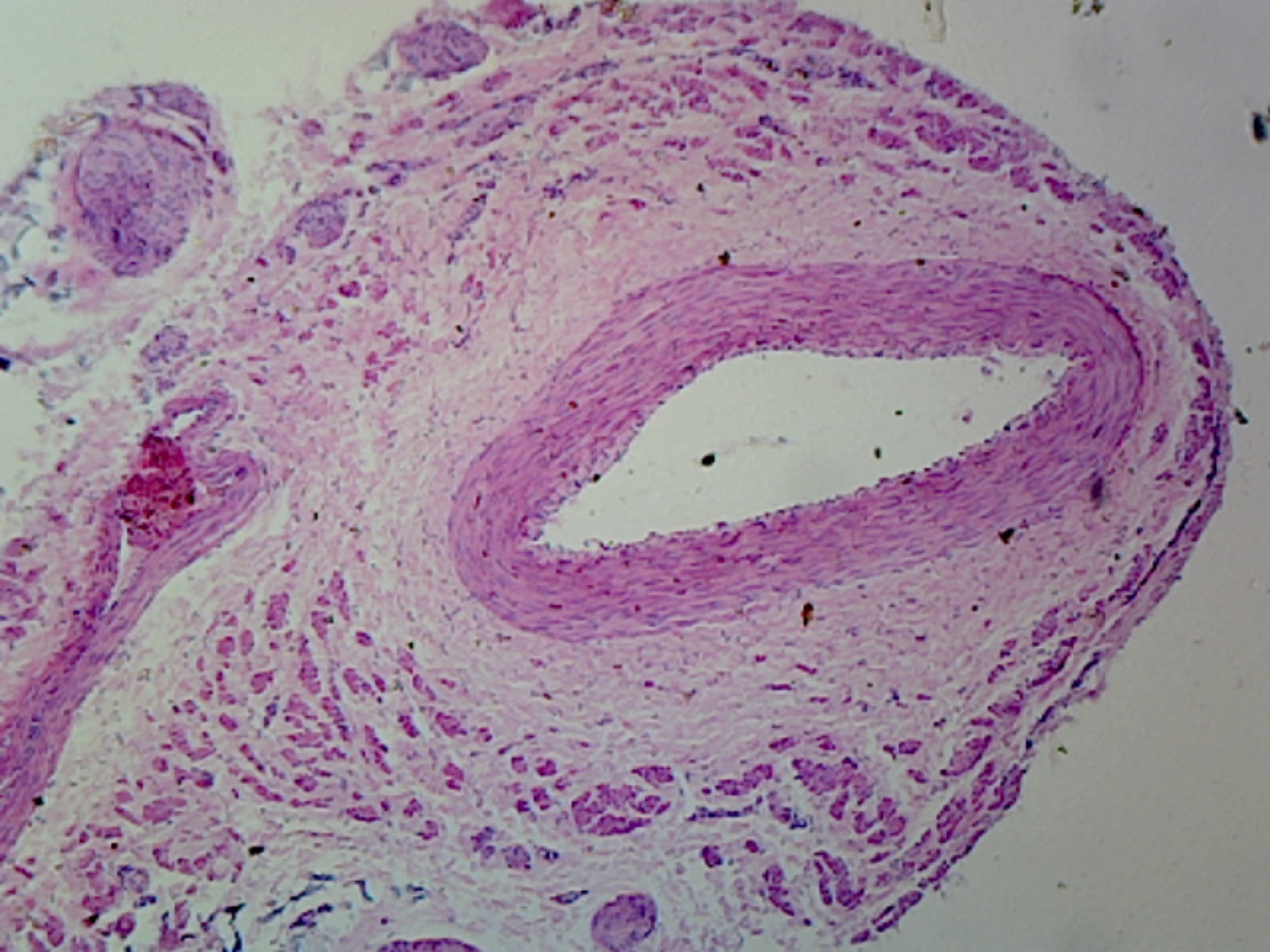 GSC International PS0146 Medium-Sized Artery and Vein, Mammalian; Cross ... GSC International PS0146 Medium-Sized Artery and Vein, Mammalian; Cross ...