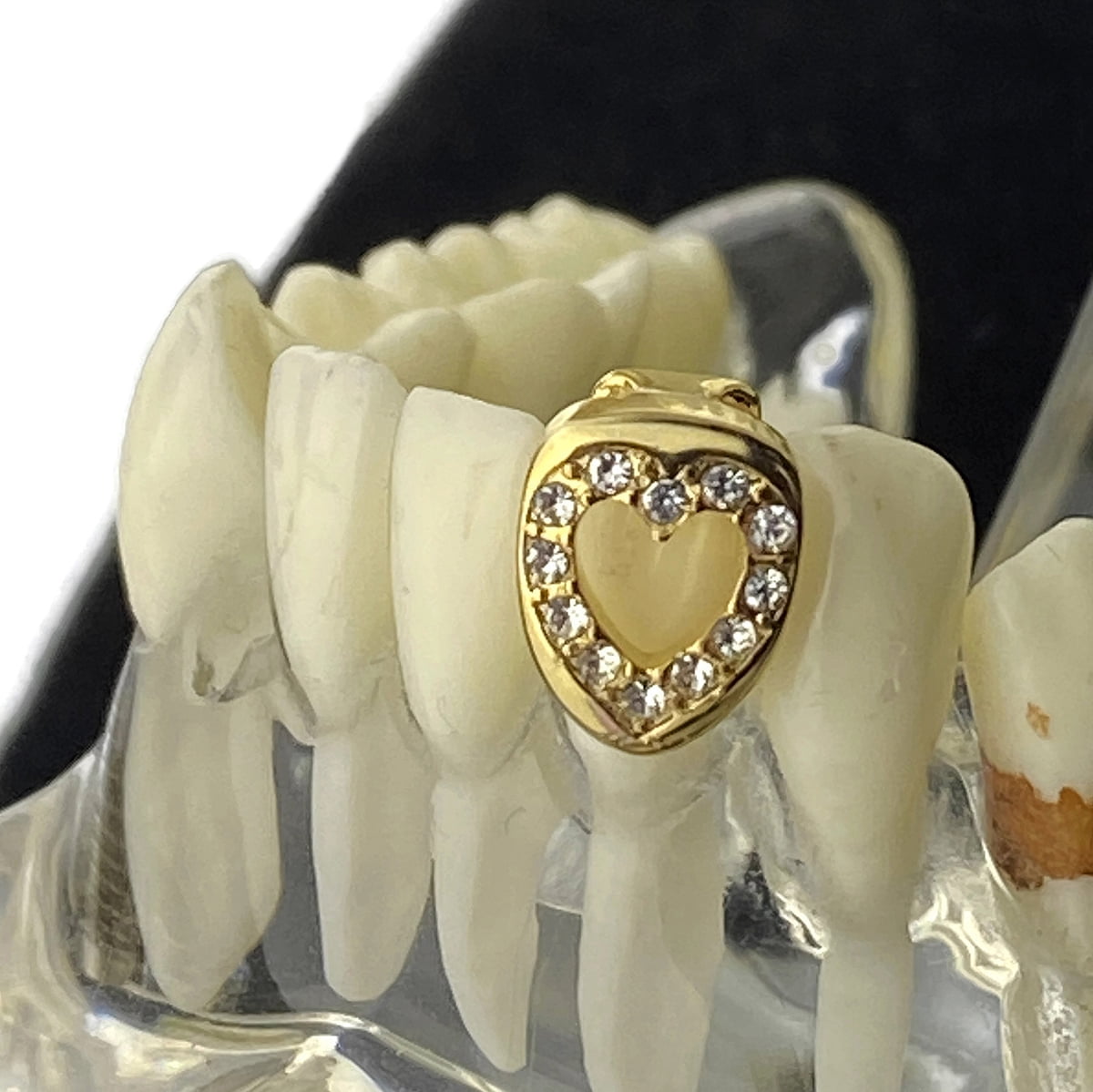 Open Face Gold Tooth Cap