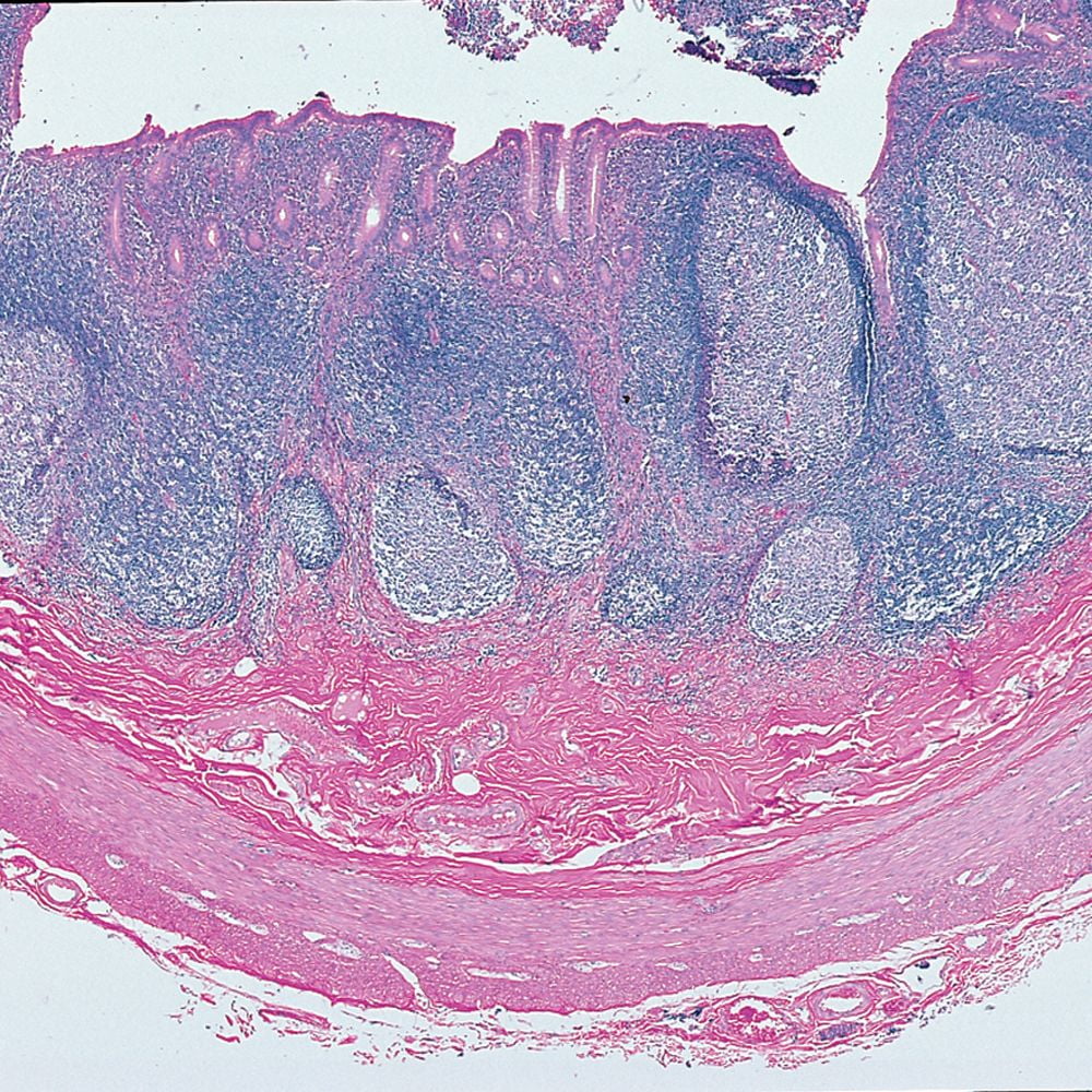 Appendix Slide