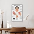 Anatomical Poster Rhinitis And Sinusitis Posters Wall Art Picture ...