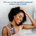 Botanic Hearth 100% Pure Rosemary Oil For Hair Growth | Infused With ...