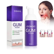 Gargax Benzocaína 2.5% 60 ml solución bucofaríngea | Walmart en línea