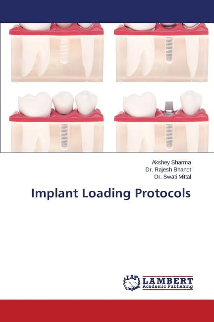 Implant Loading Protocols (Paperback) - Walmart.com