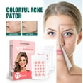 Xerdsx Star Blue and Green Pimple Patches, Cute Patches for face with ...