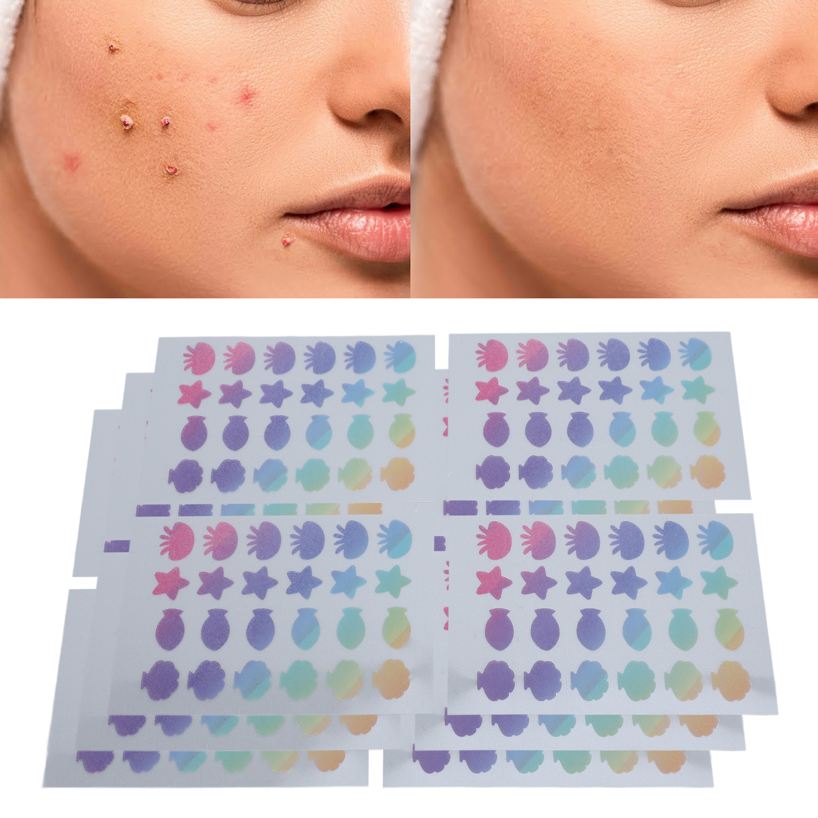 Patch de Espinilla, Parches Zit Lindos Secrecios de absorción Colorida ...