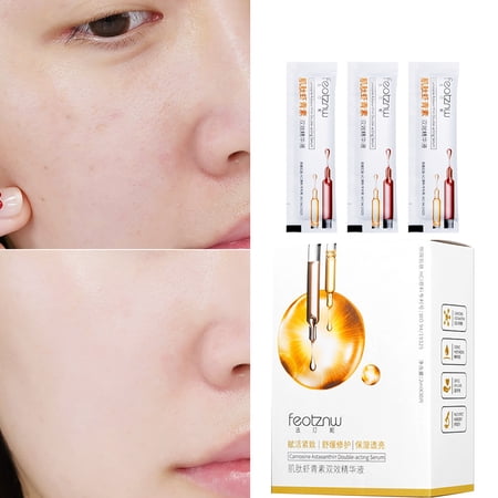 Archer 2ml 30 Bags/Box Facial Liquid Multifunctional Non-Irritating ...