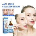 30ml Clostridium Botulinum Wrinkle Remover Instant Anti-aging Face ...