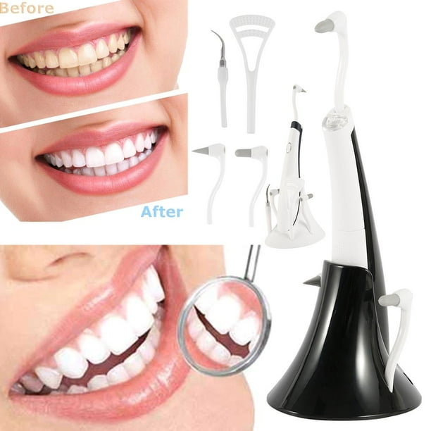 Tooth Cleaner Oral Dental Teeth Stain Cleaning Electric Ultrasonic ...