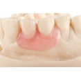 DIY- Impression | Flexible Partial Denture | Flipper - Walmart.com