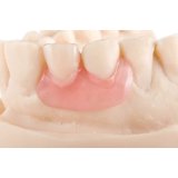 DIY- Impression | Flexible Partial Denture | Flipper - Walmart.com