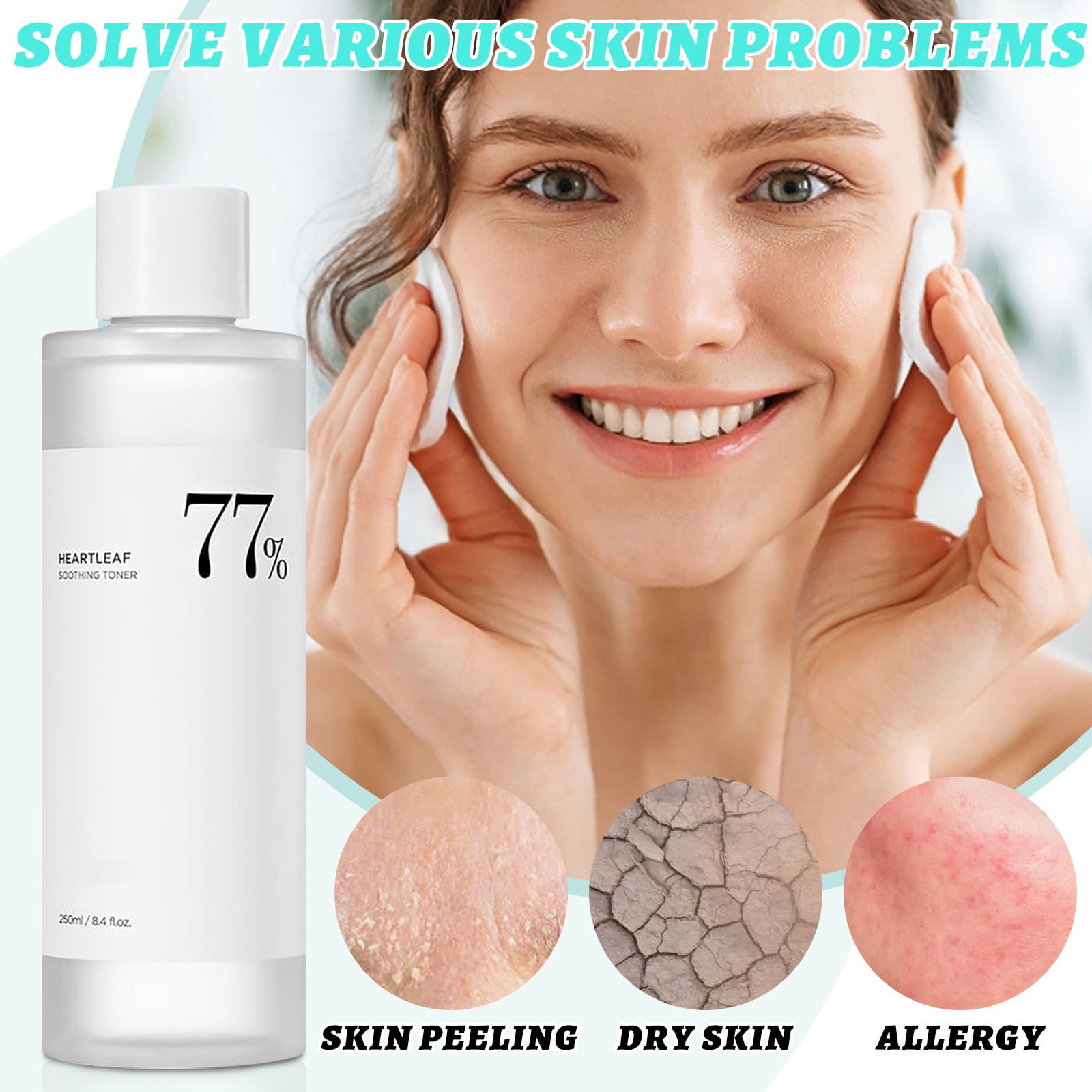 Houttuynia Cordata Tónico, Acné Cerrado, Eliminación Del Acné, Calmante ...