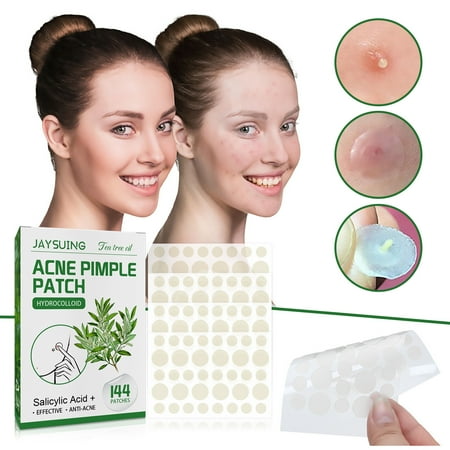 SICED 144pcs Invisible Pimple Spot Patches Hydrocolloid Acnes Effective ...