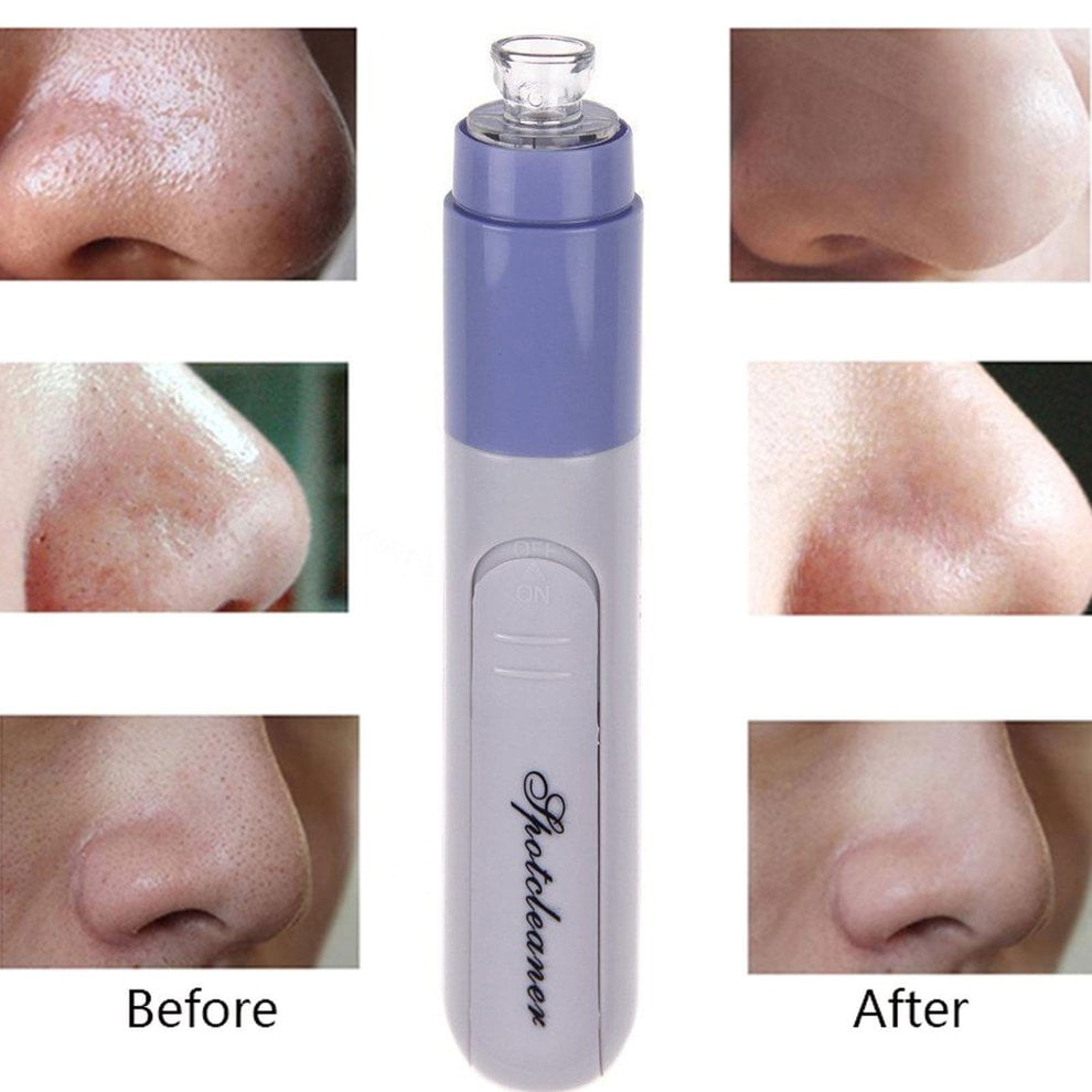 Electric Facial Pore Cleanser Spot Cleaner Face Blackhead Acne Suction ...