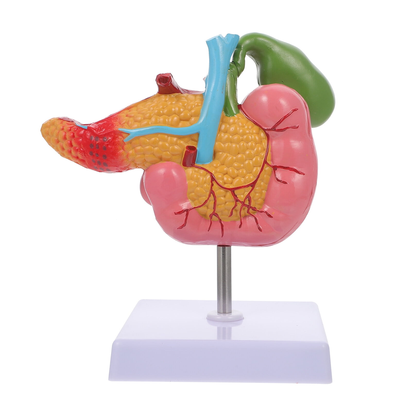 Duodenal lesion model Human Pancreas Model Duodenal Gallbladder ...