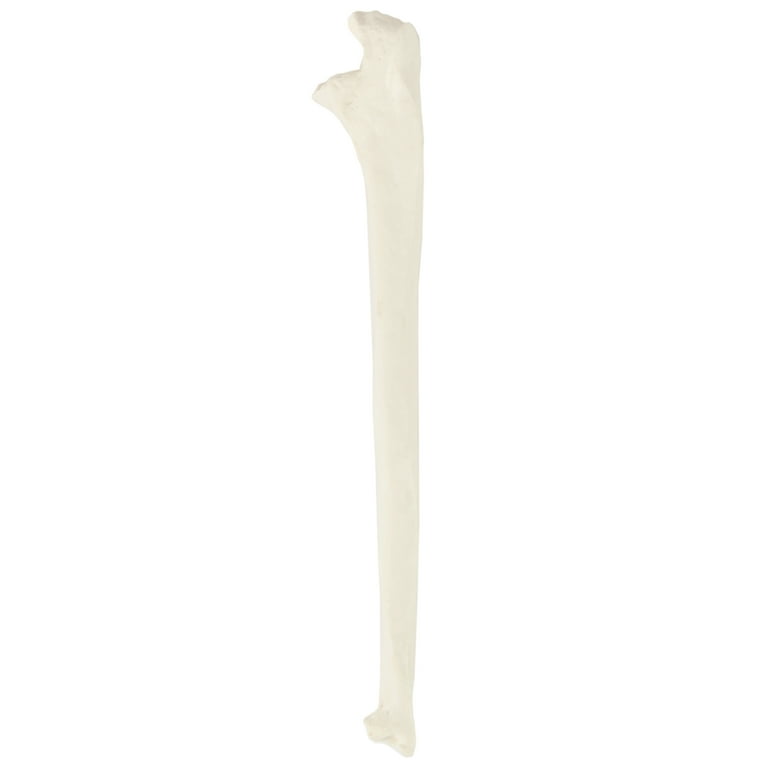 Right Ulna