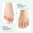 Pluokvzr 20 Pcs SEBS Gel Big Toe Caps, Antiskid Protectors, For Pain ...