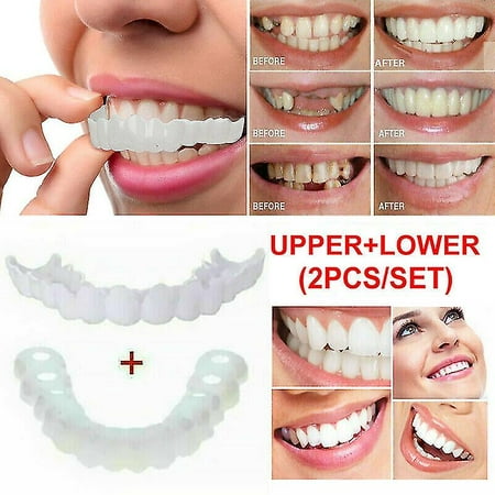 Snap On False Teeth Upper + Lower Dental Veneers Dentures Tooth Cover ...