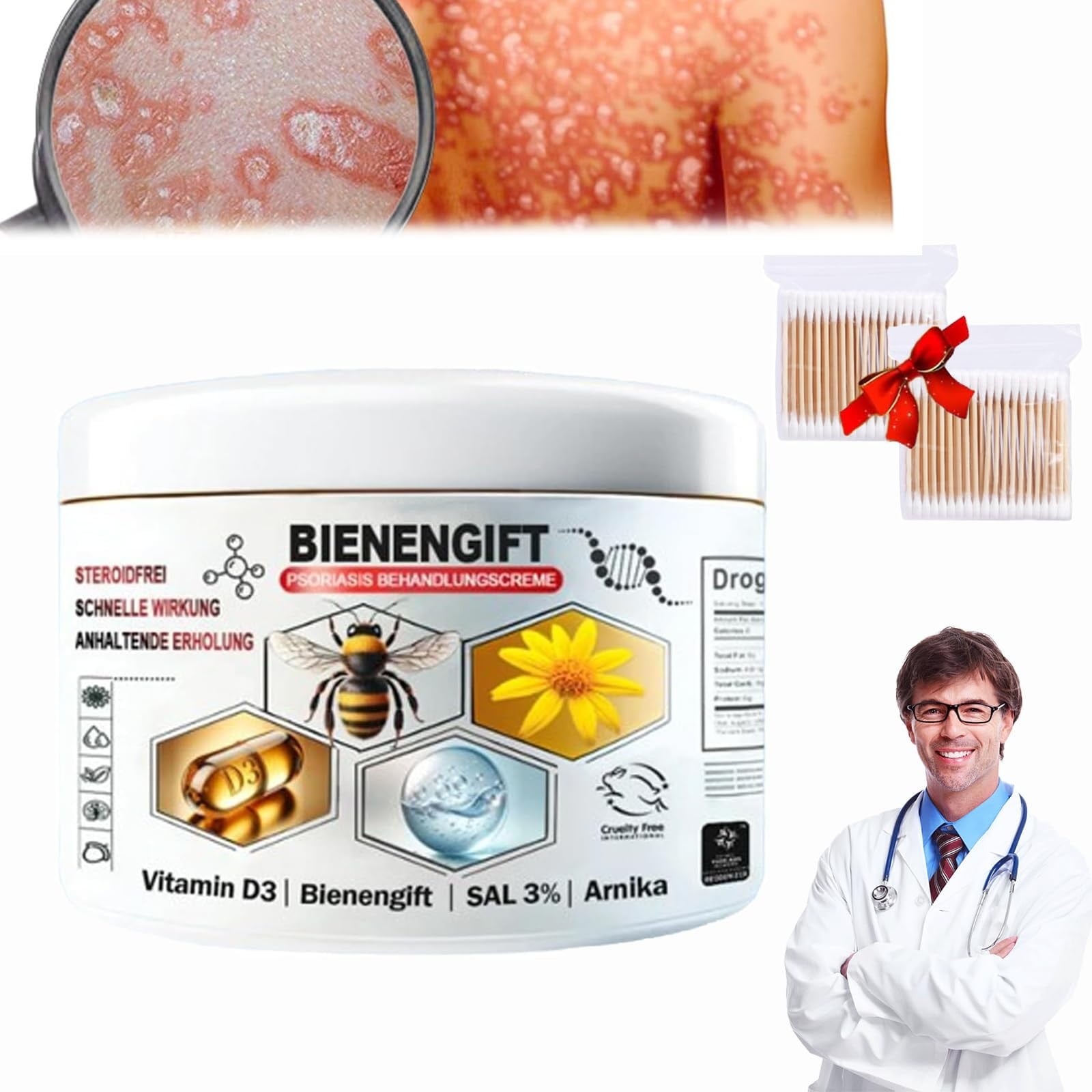 Mejor Belleza Bee Psoriasis , Bee Ointment, Bee Psoriasis , Bee Relief ...