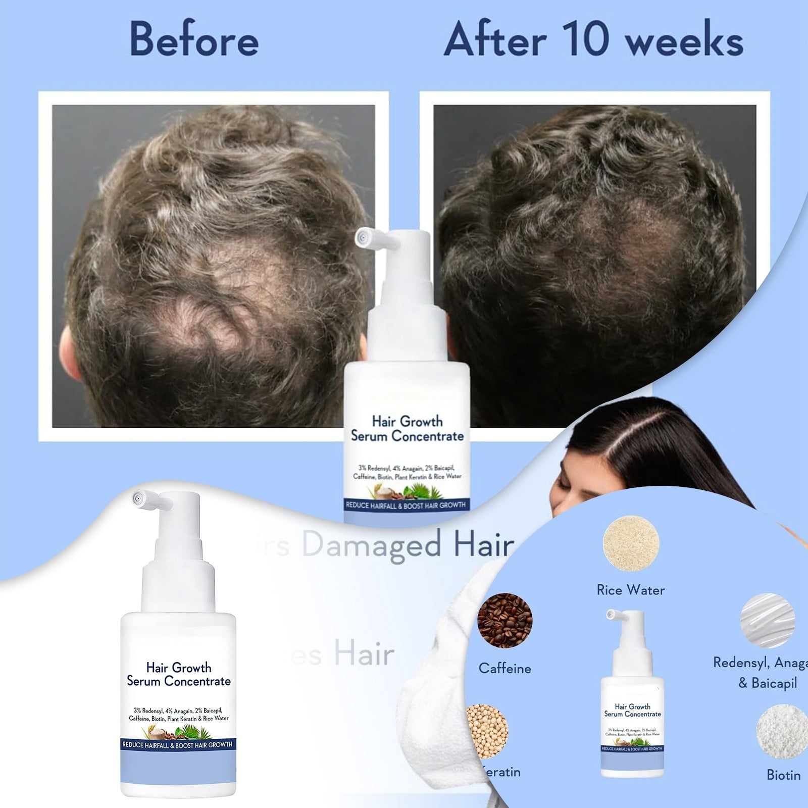 Click here for Dfx Wish Care Hair Growth Serum Concentrate 9.5x3.... prices