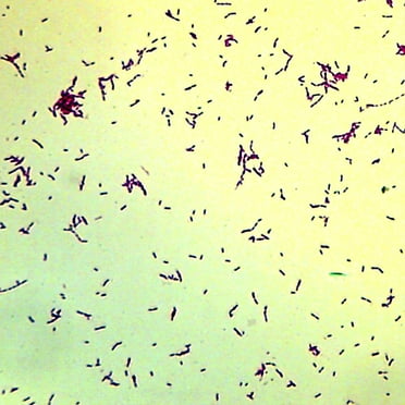 Spider Prepared Microscope Slide, Whole-Mount - Walmart.com