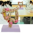 Human Pathologies of Large Intestine Model Medicals Teaching Tool Human ...