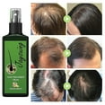Jaysuing 120ml Hair Growth Oil Hair Lotion New Pack Scalp Massage