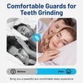 XIRQI 2026 New Mouth Guard for Grinding Teeth at Night,Prevents Tooth ...