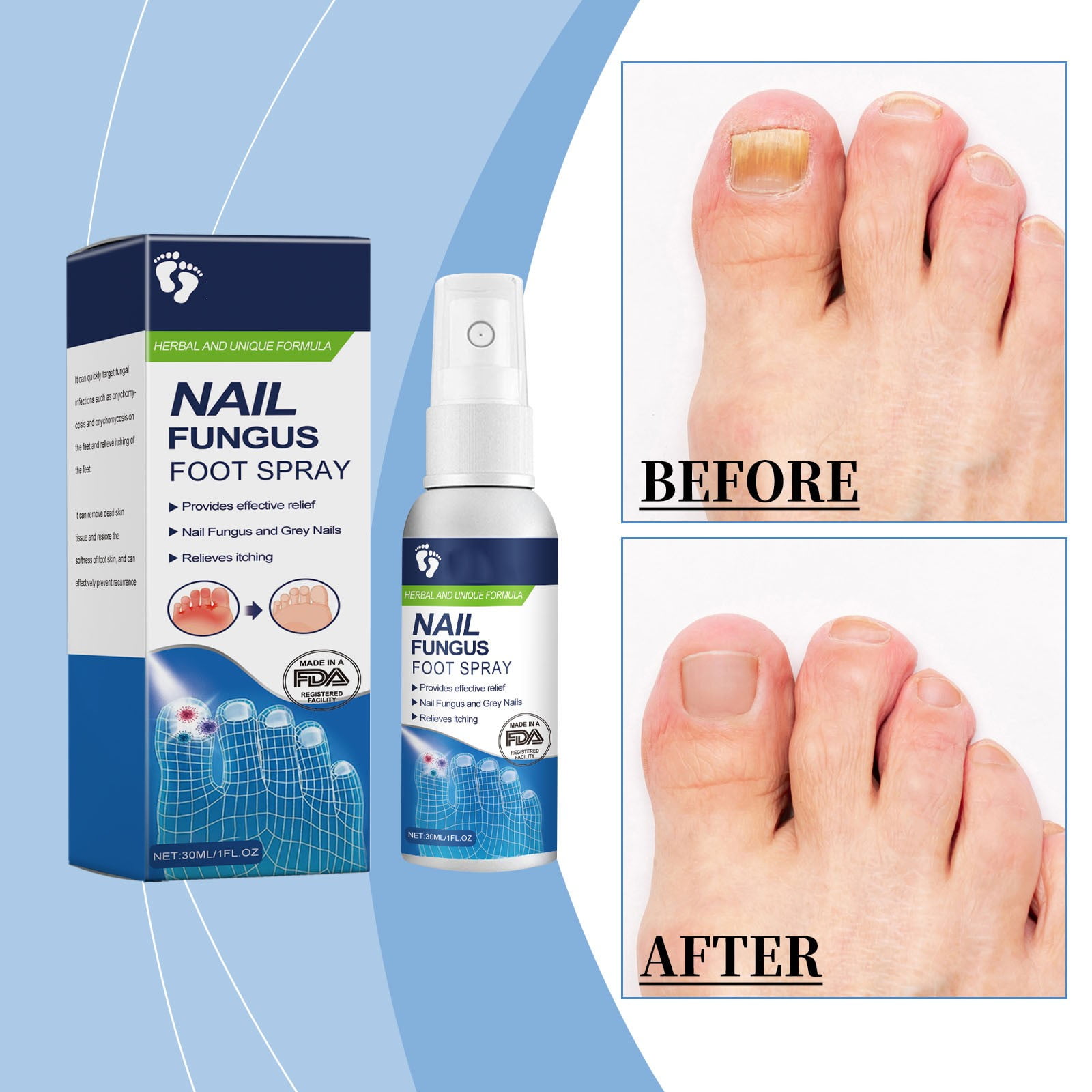 Click here for Foraging Dimple Foot Odor Sprayantibacterial Deodo... prices