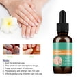 30ml Anti-Fungal Nail Solution for Fingers and Toes - Treats Fungal ...