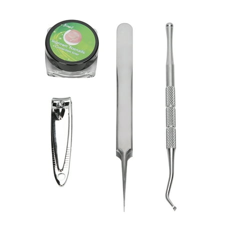 Ingrown Toe Nail Correction Tools,Ingrown Toe Nail Correction Ingrown ...