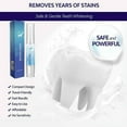 Braces Flossing Threads Teeth n Ear Wax Water Flush Desensitizing ... Braces Flossing Threads Teeth n Ear Wax Water Flush Desensitizing ...