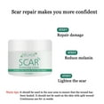 Scar Removal Cream for Acne Scars, Surgery, Cuts, Burns - Stretch Marks Remover Cream for Face ...
