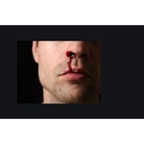 NasalCease First Aid for Cuts & Nosebleeds, 5 Count - Walmart.com