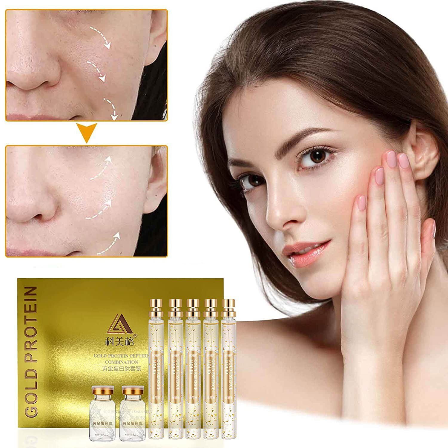 Buy Protein Thread Lifting Set, Soluble Protein Thread and Nano Gold ...